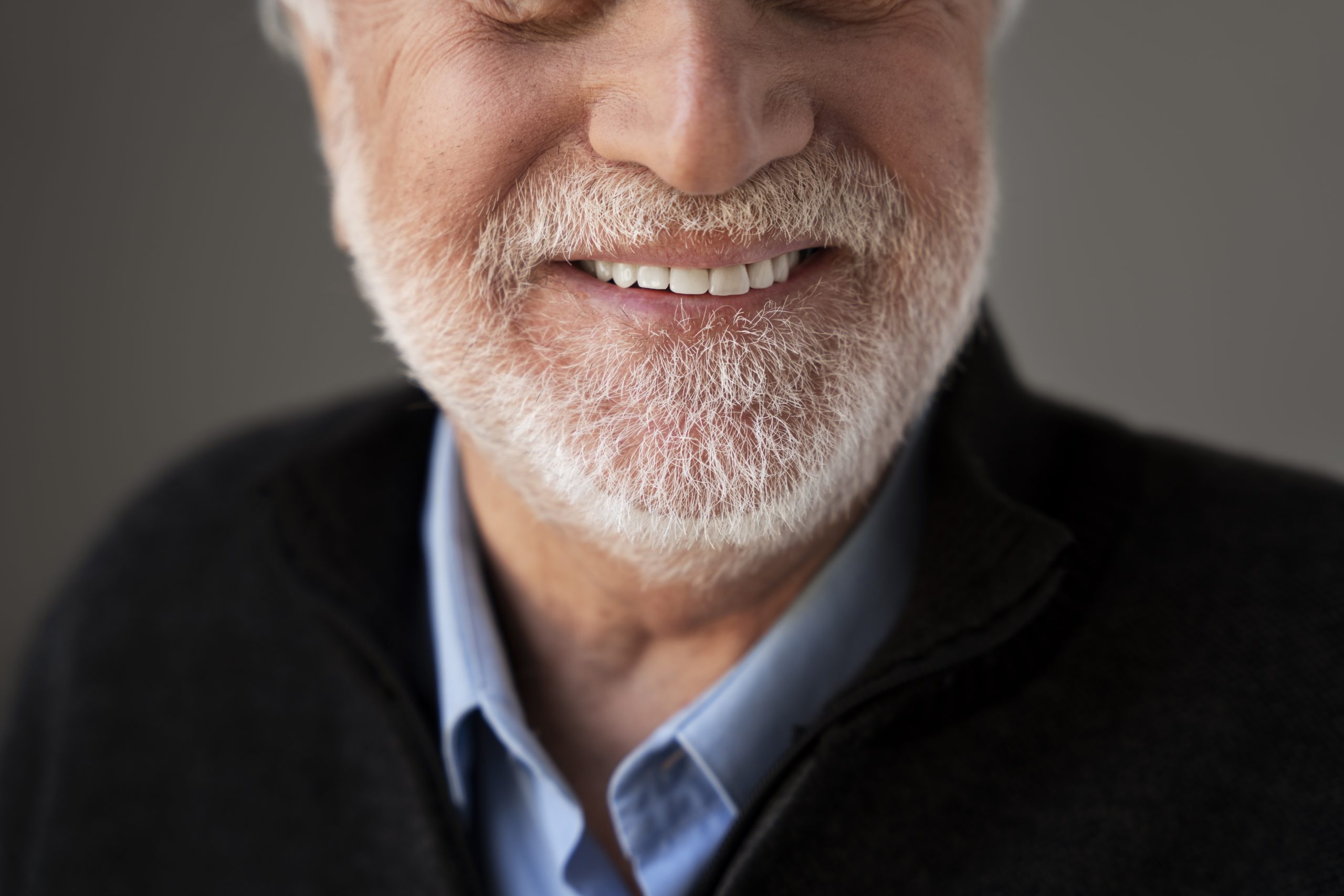 What Makes Dentures Look Natural? | Shape, Fit, and Colour